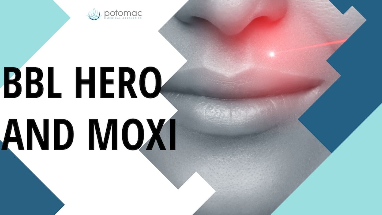 BBL Hero & MOXI - Potomac Medical Aesthetics
