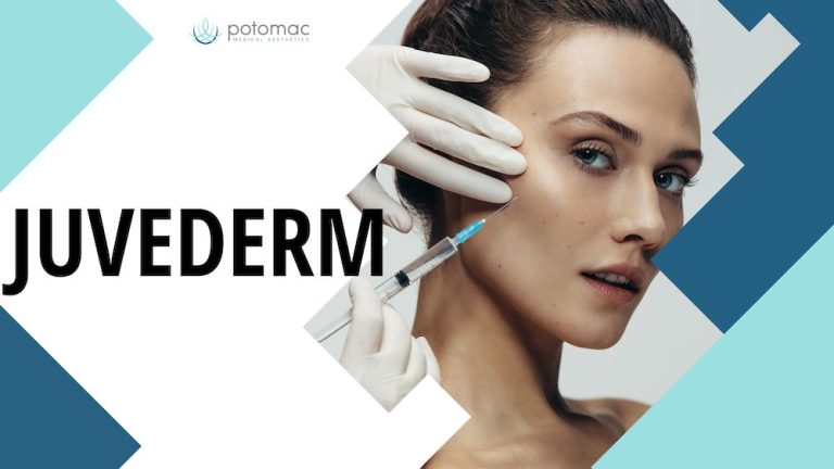 Juvederm - Potomac Medical Aesthetics