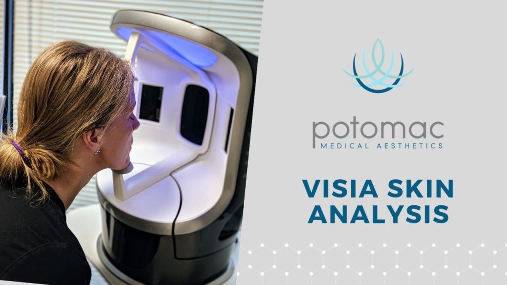 Visia Skin Care Cream Uses In Hindi at Rudolph Miller blog