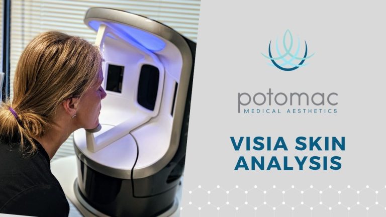 Visia Skin Analysis - Potomac Medical Aesthetics